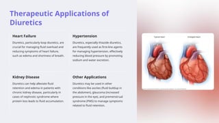 DIURETICS diuretics, classification, mechanism of action, site of ...
