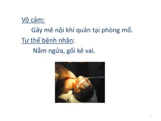 Di vat 2 | PDF