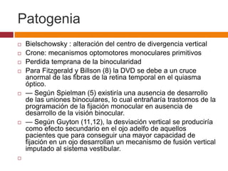 Divergencia vertical disociada | PPTX