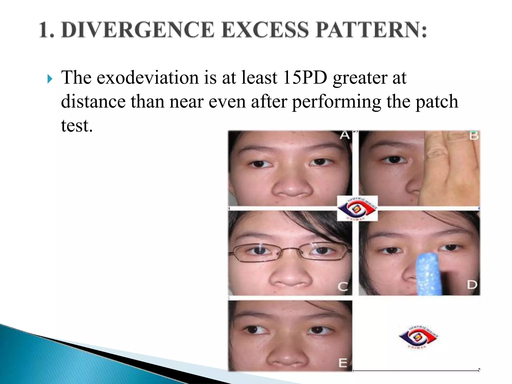 divergent squint.pptx