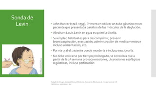 DIVERSOS TIPOS DE SONDA.pptx