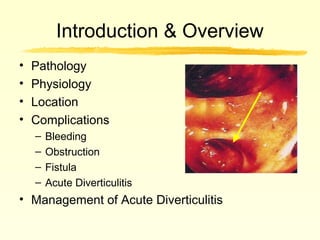 Diverticular disease | PPT