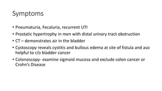 Diverticular disease- surgical perspective | PPTX