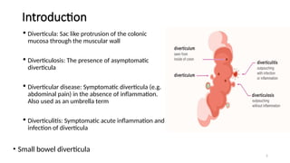 Diverticular Disease by Dr. Aayush Bimali.pptx