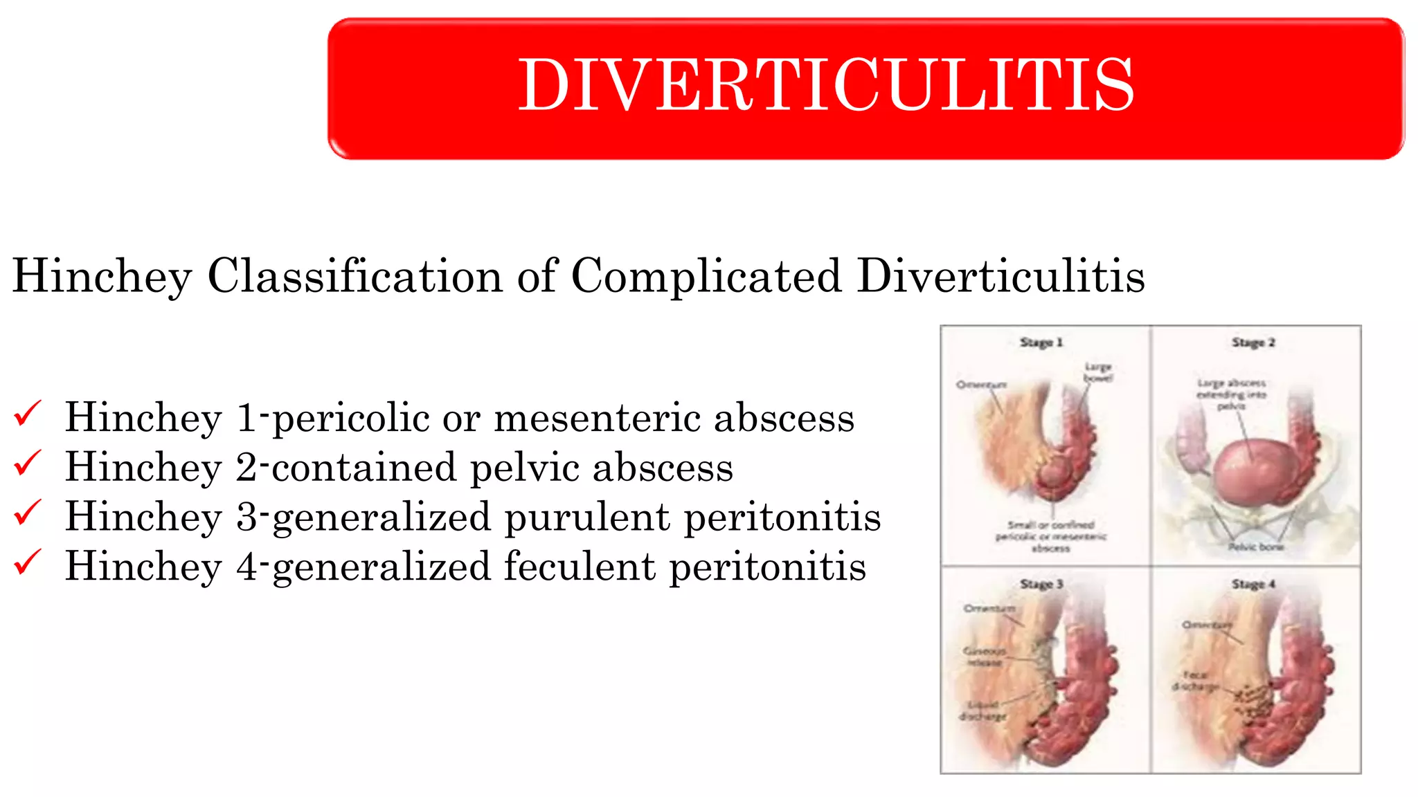 Diverticular Disease-Lower GI Hemorrhage | PPTX