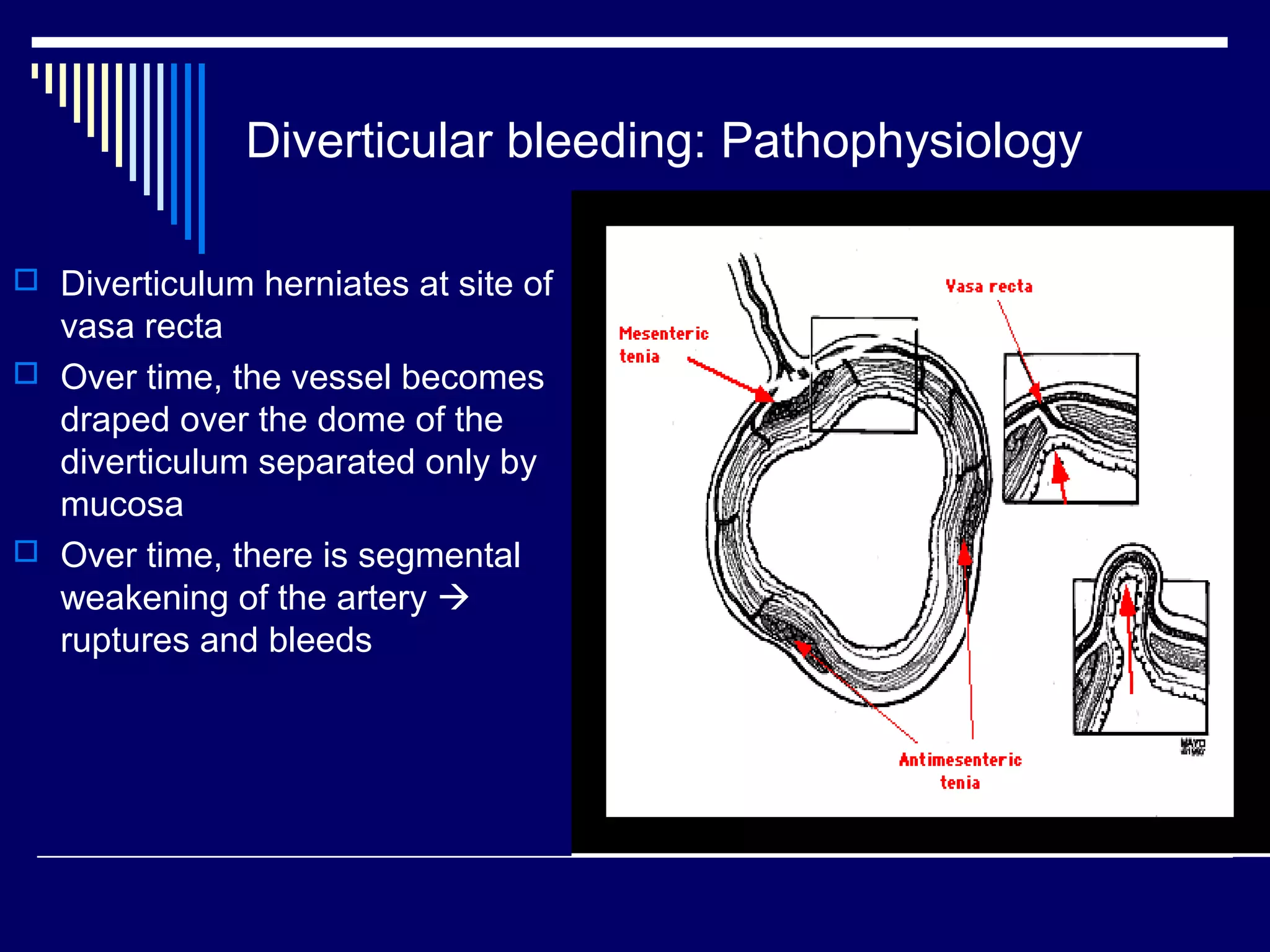 Diverticular disease of colon | PPT