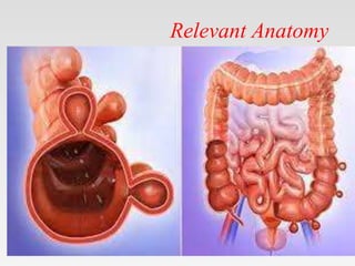 Diverticular disease of colon.pptx