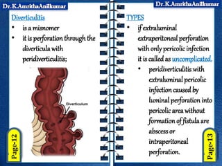 Diverticular diseases of colon by Dr.AmrithaAnilkumar | PPT