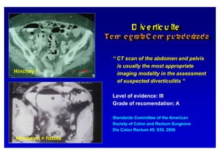 ESTUDO SOBRE DIVERTICULITE AGUDA. CIRURGIA | PPTX