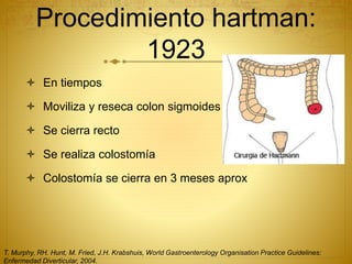 Enfermedad Diverticular: Diverticulosis, Diverticulitis, Hemorragia ...