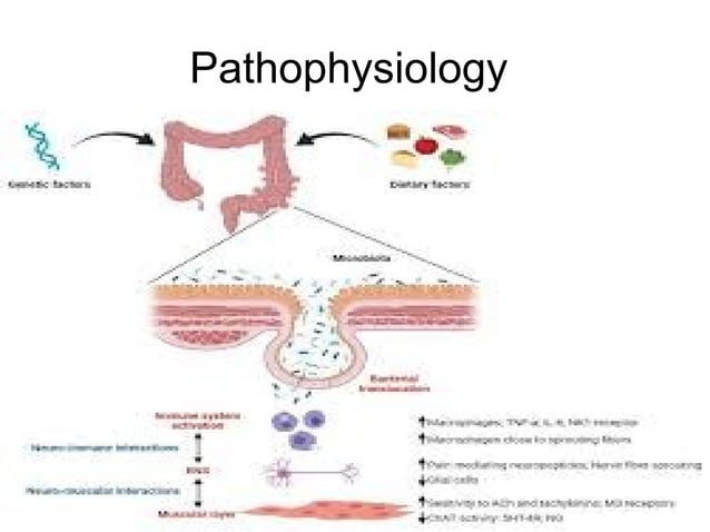 Diverticulitis and its nursing management.ppt