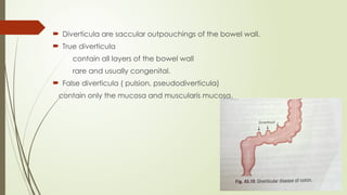 diverticulitis.pptx surgery ppt diverticulitis | PPTX