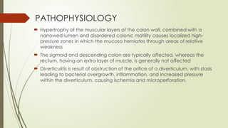 diverticulitis.pptx surgery ppt diverticulitis | PPTX