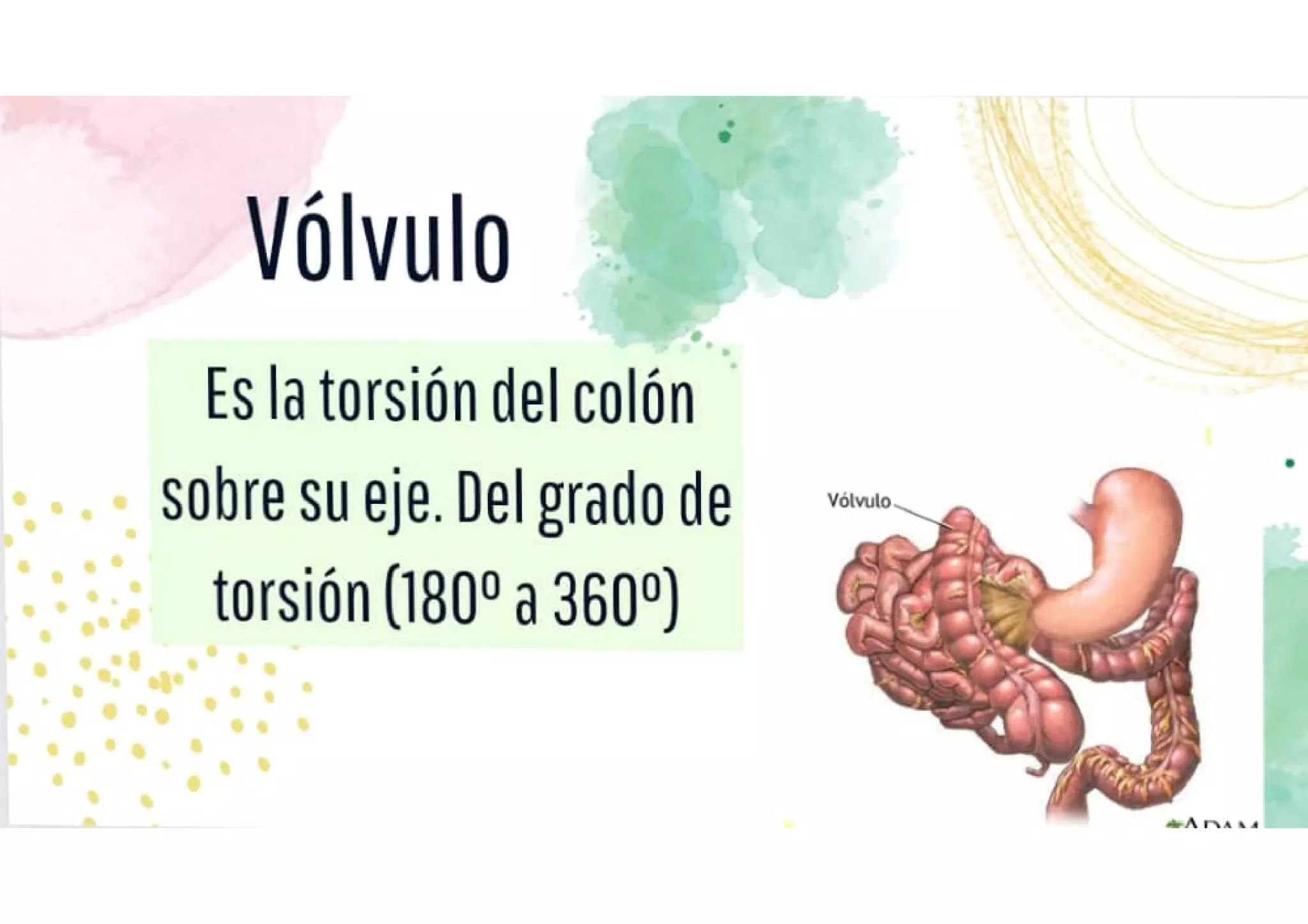 Diverticulitis-Diverticulosis-Vólvulo-Megacolon.pdf
