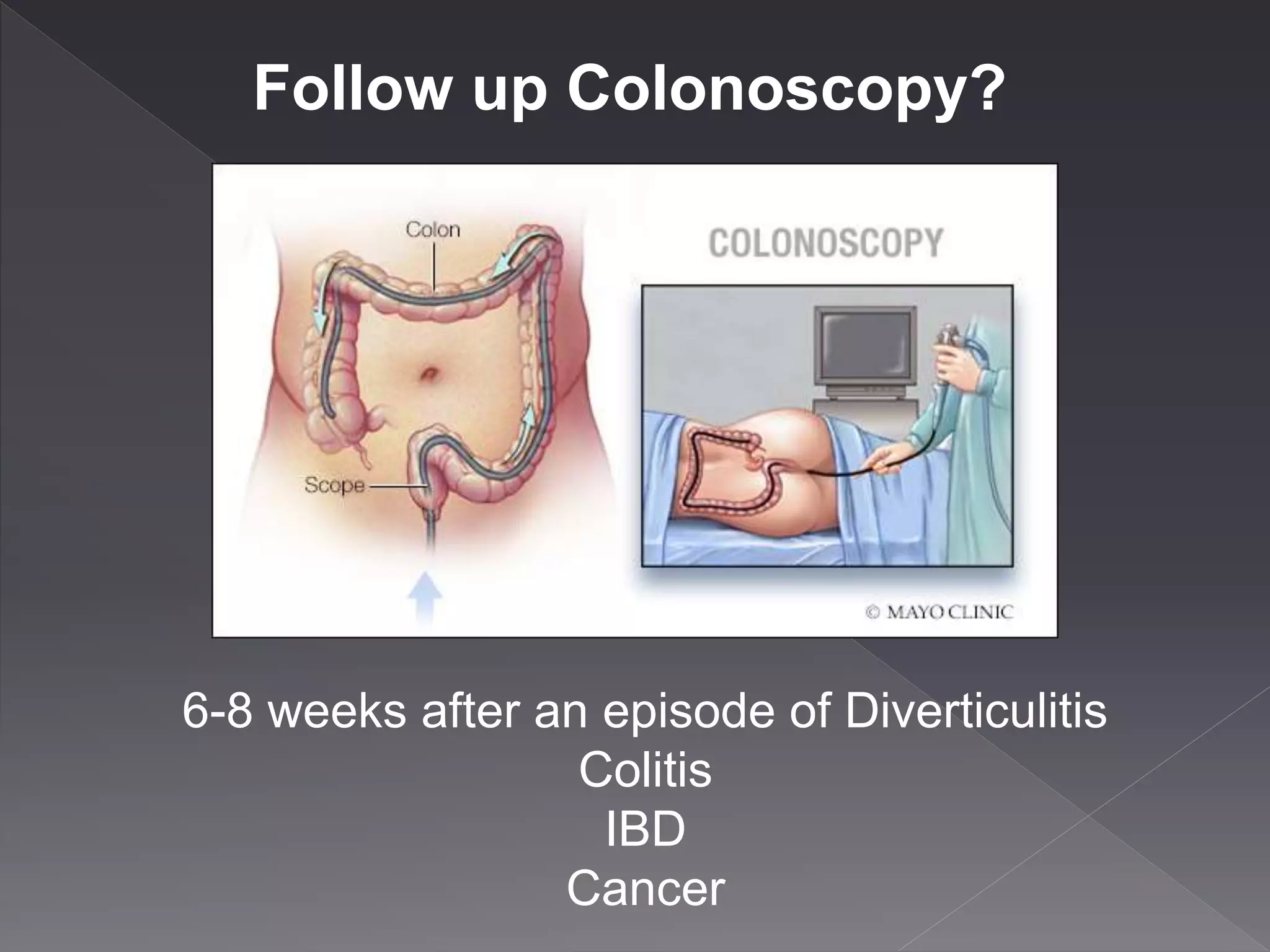 General Colorectal Review/ Diverticulitis | PPTX