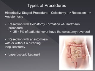 General Colorectal Review/ Diverticulitis | PPTX
