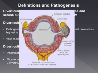 General Colorectal Review/ Diverticulitis | PPT