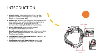 Diverticulitis Journal Club Presentation | PPTX