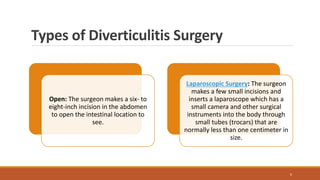 Diverticulitis Surgery - Procedure and Recovery Southlake.pdf