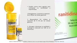 Diverticulo de Meckel y tratamiento quirúrgico | PPTX