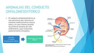 Diverticulo de Meckel.pptx