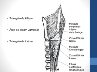 Diverticulos esofagicos | PPT