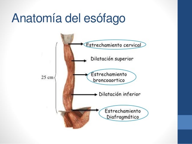 Diverticulos esofagicos