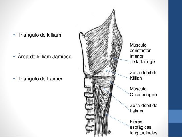 Diverticulos esofagicos