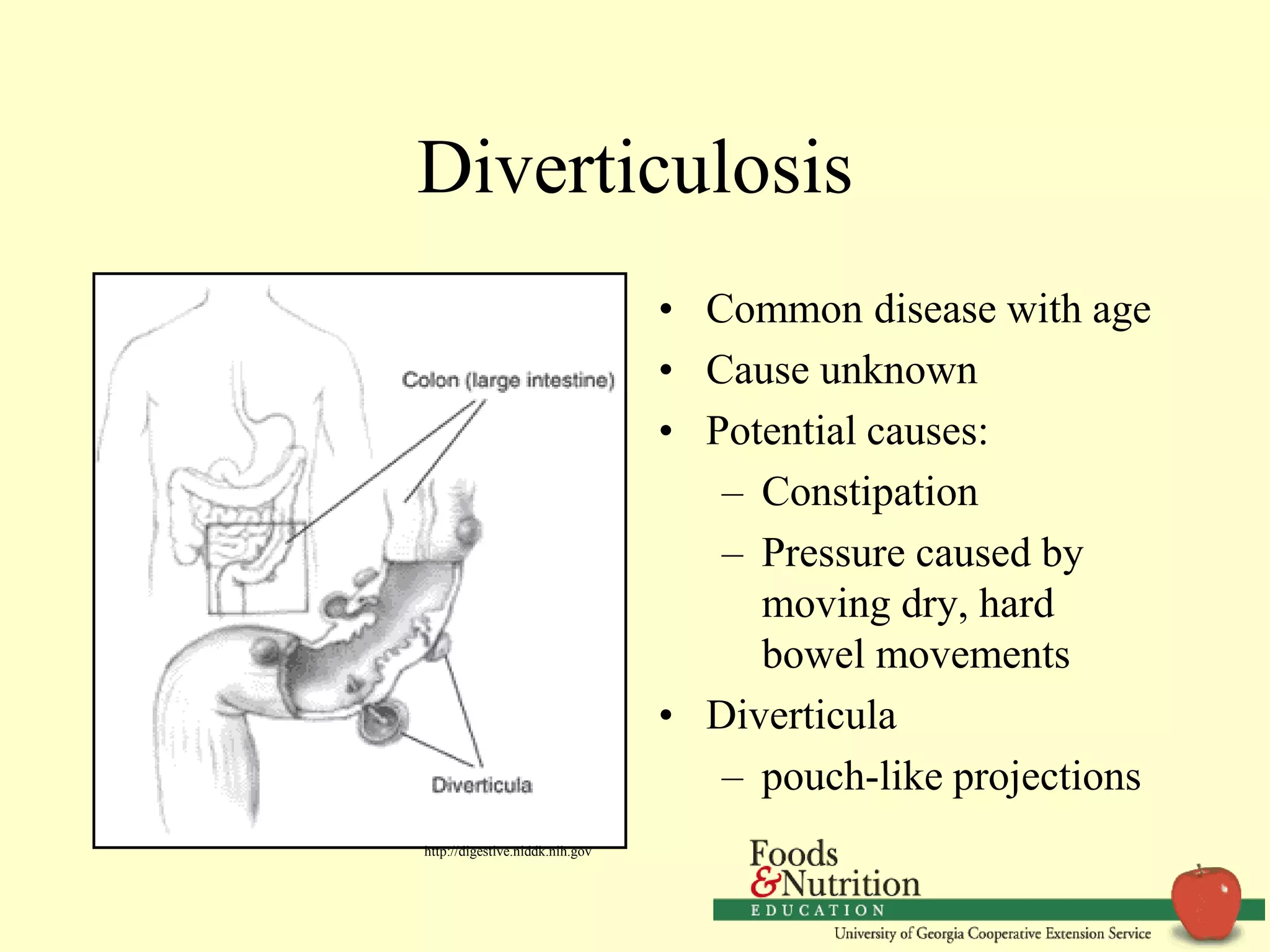 diverticulosis 2016.ppt | Digestive Disorders | Diseases and Conditions