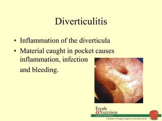 diverticulosis 2016.ppt | Digestive Disorders | Diseases and Conditions