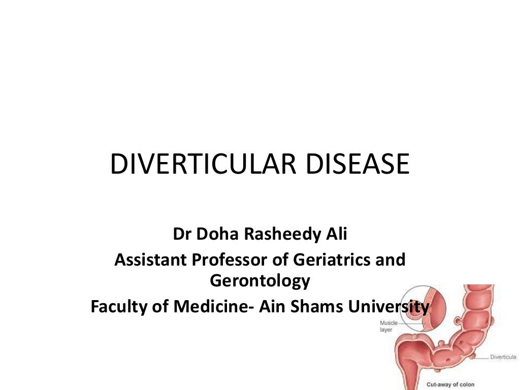 Diverticulosis and diverticular disease | PPTX | Digestive Disorders | Diseases and Conditions