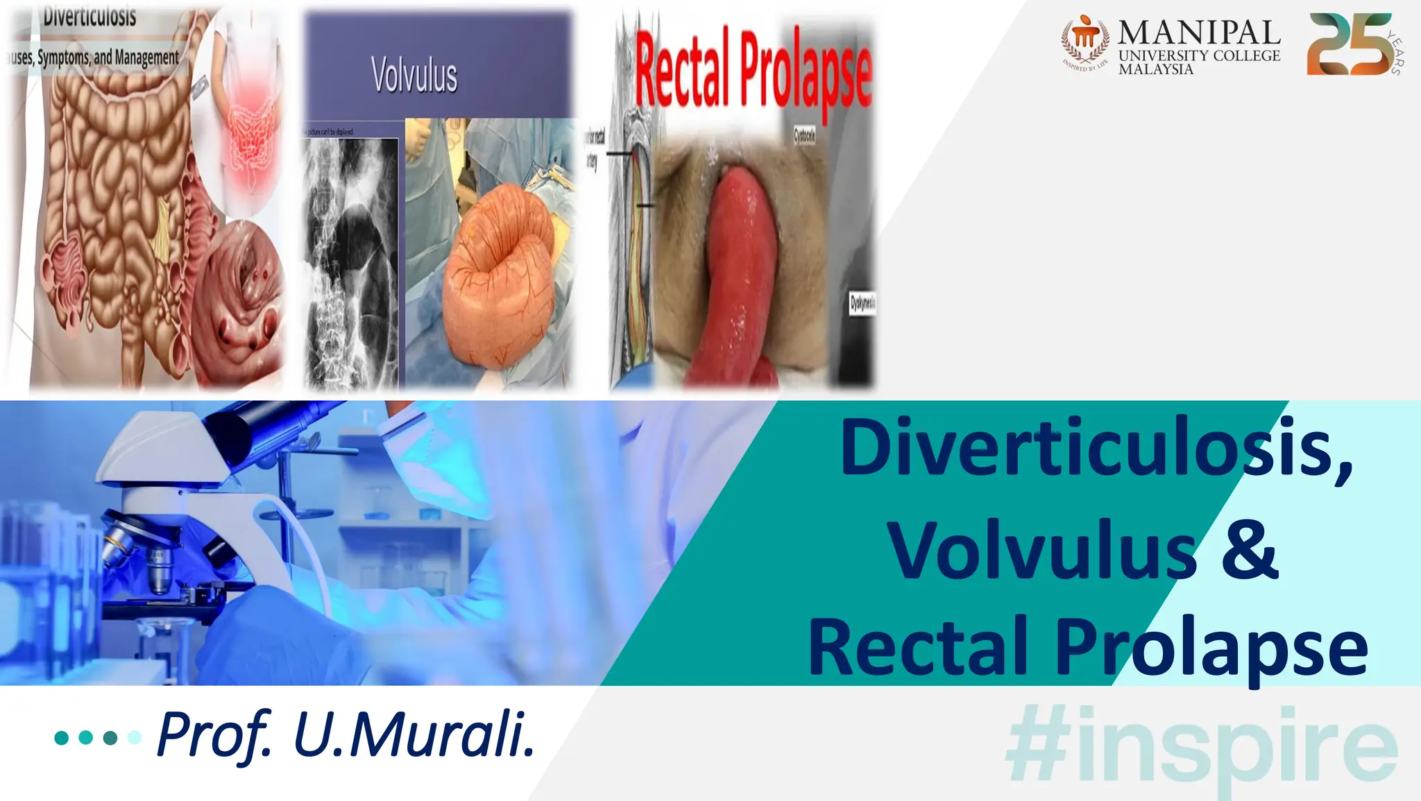 Diverticulosis, Volvulus & Rectal prolapse.pdf