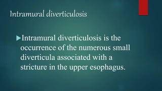 DIVERTICULUM.pptx