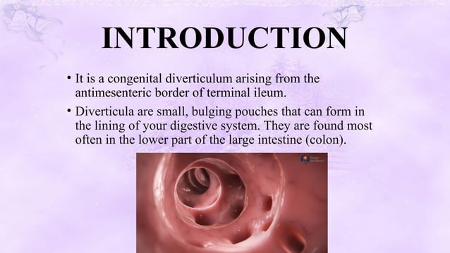 DIVERTICULUM.pptx- introduction, definition, causes,clinical ...