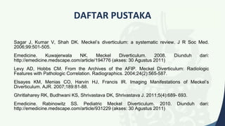 divertikulum meckel (1).pptx