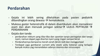 divertikulum meckel (1).pptx