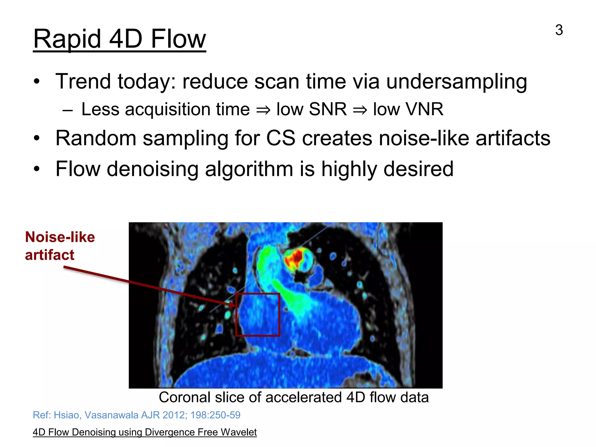 Improved Visualization and Quantification of 4D Flow Data using ...