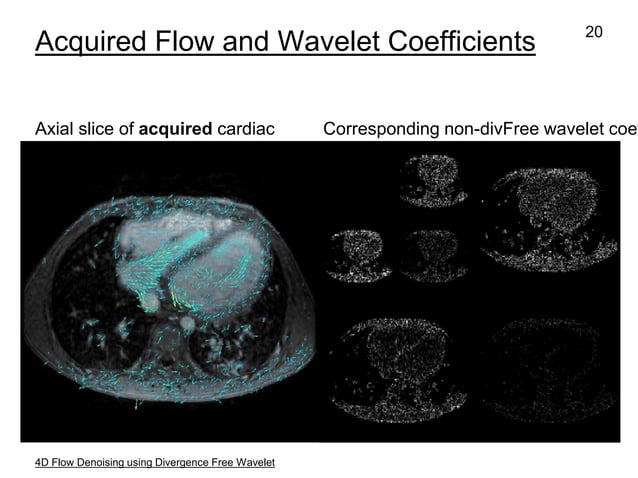 Improved Visualization and Quantification of 4D Flow Data using ...