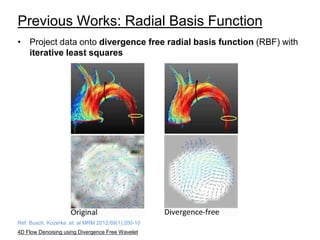 Improved Visualization and Quantification of 4D Flow Data using Divergence-free Wavelet ...