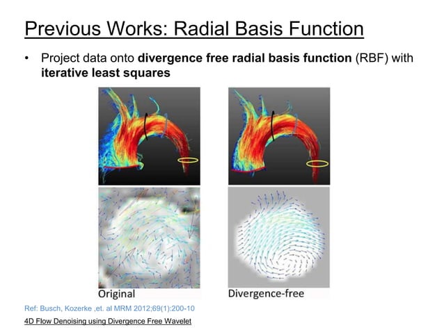 Improved Visualization and Quantification of 4D Flow Data using Divergence-free Wavelet ...
