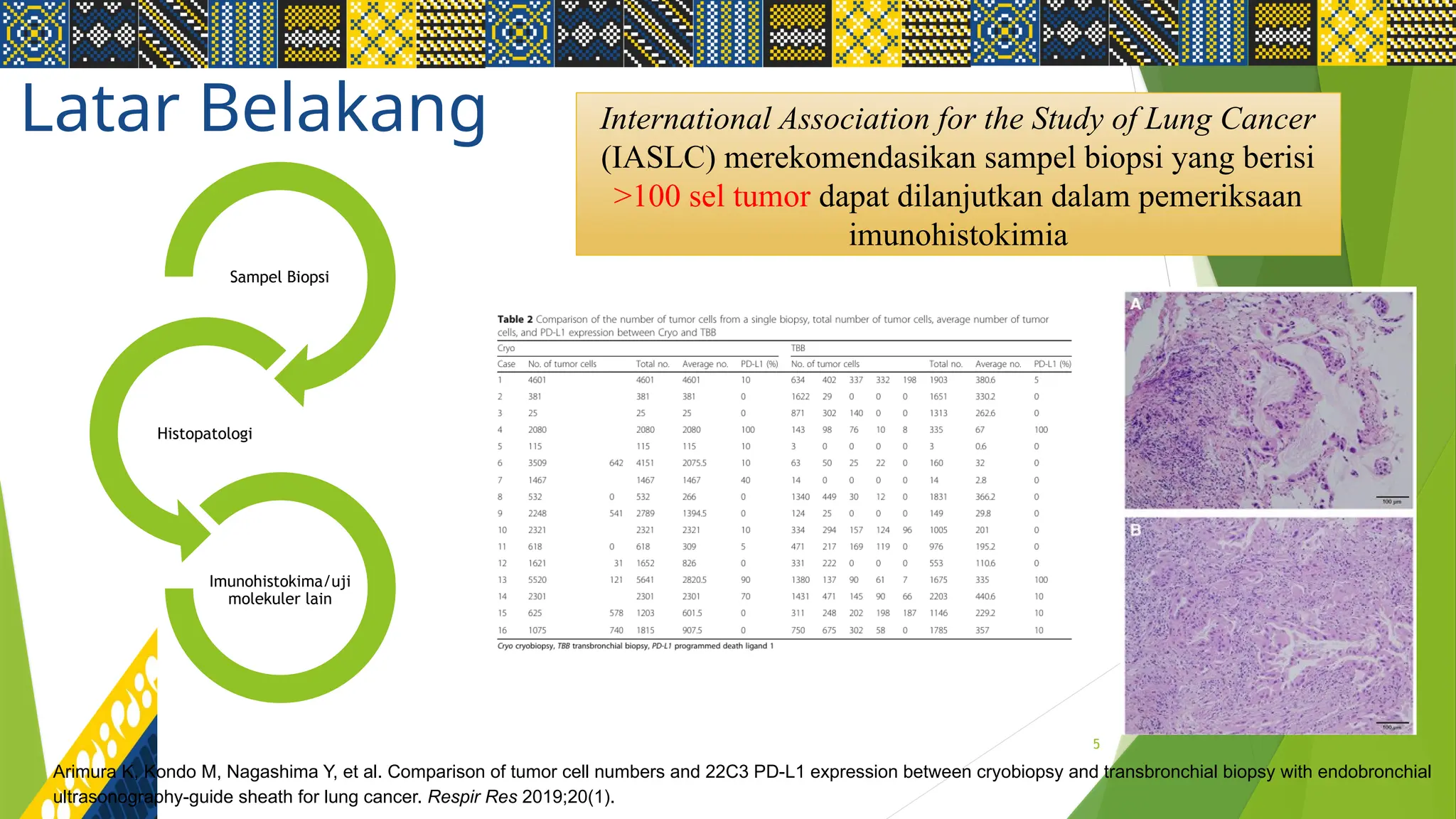perbedaan ekspresi PDL1 pada biopsi transbonkial | PPTX