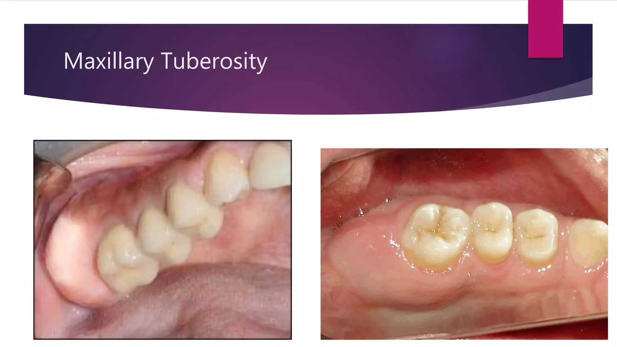Divisions of the oral cavity | PPTX