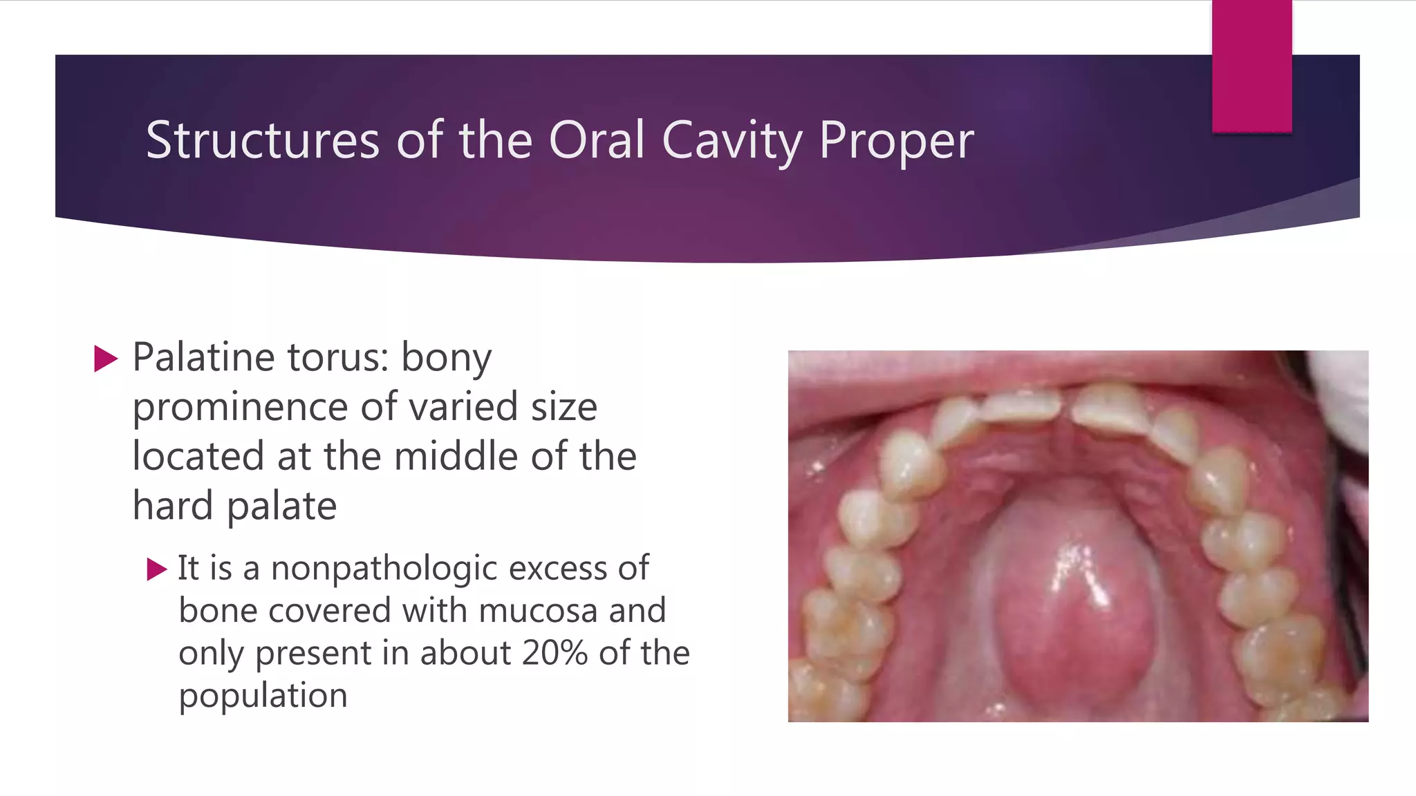 Divisions of the oral cavity | PPTX