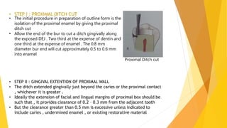 TOOTH PREPARATION FOR CLASS II AMALGAM RESTORATION | PPTX