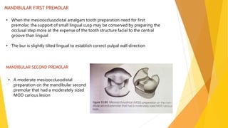 TOOTH PREPARATION FOR CLASS II AMALGAM RESTORATION | PPTX