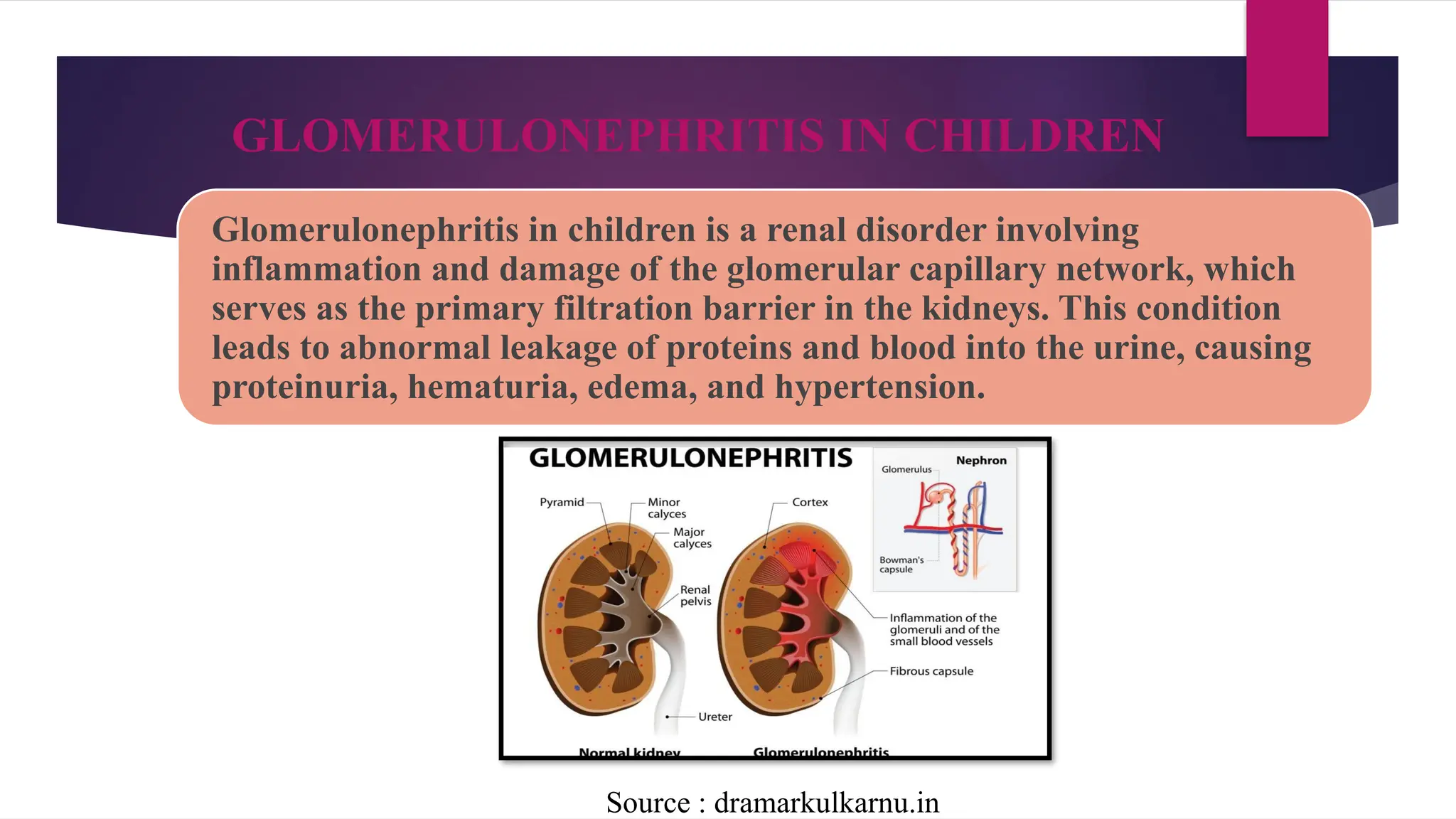RENAL DISEASES IN CHILDREN PPT BY DIVYAJYOTHI THOTA | PPTX