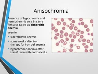 Peripheral blood smear pathology........... | PPTX