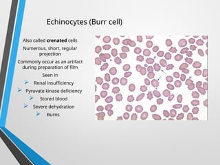 Peripheral blood smear pathology........... | PPTX