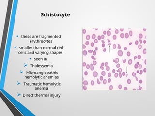 Peripheral blood smear pathology........... | PPTX
