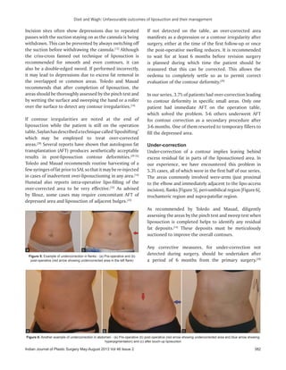 complications of liposuction powerpoint presentation | PDF